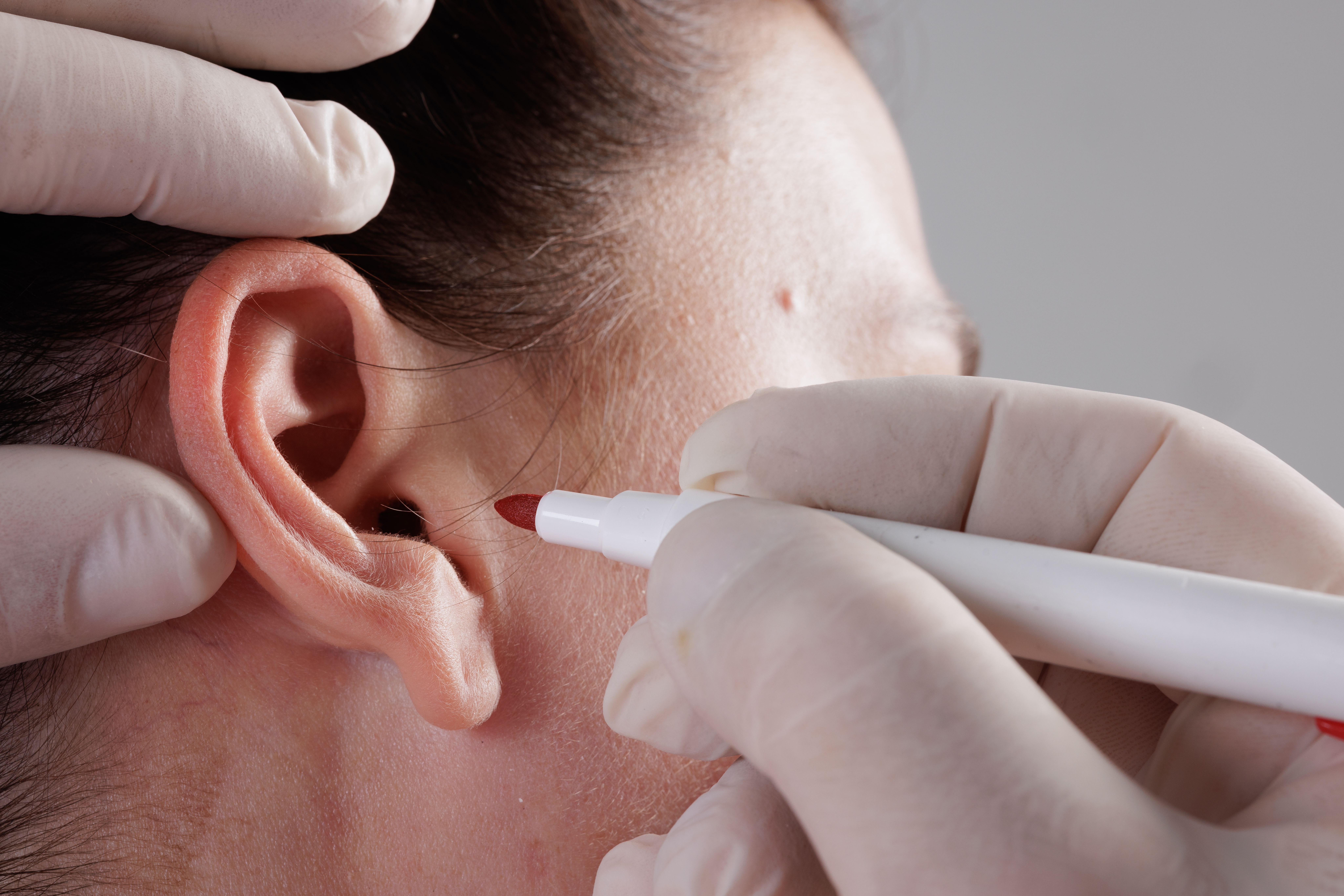 Ear Lobe Repair Surgery in Rockville, MD | Metro ENT & FPS
